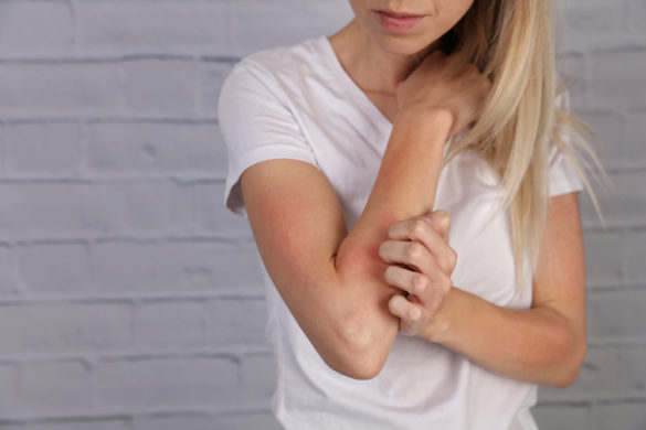 Ausschlag am Arm: Symptome, Ursachen und Behandlung