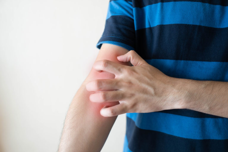 Ausschlag am Arm: Symptome, Ursachen und Behandlung